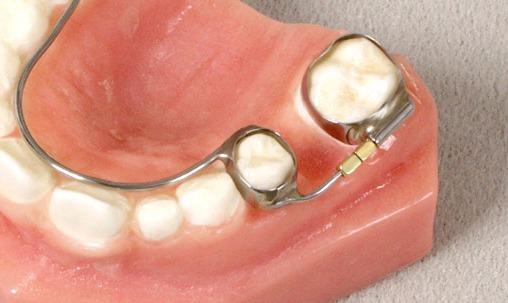 Ordont Orthodontic Appliance Laboratories Fenton, Missouri - Dentists